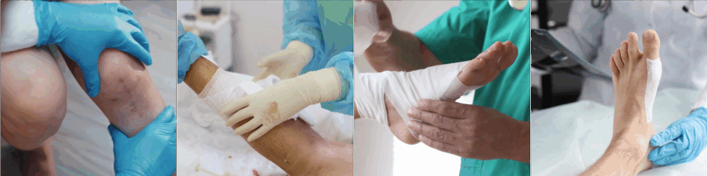 Innovation Wound Care Nursing Facilites Partner